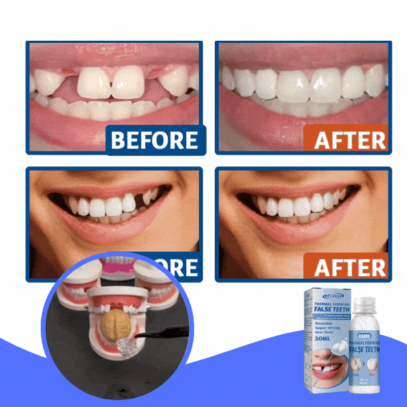 Resin Dentures Temporary Repair Teeth
